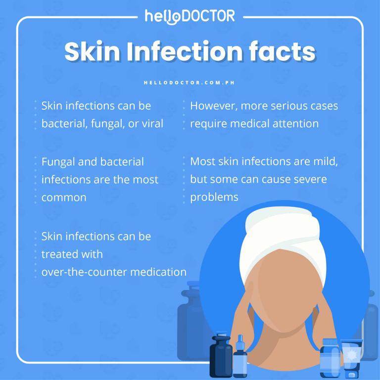 Akapulko Plant: How Does It Benefit Your Health? Learn More Here