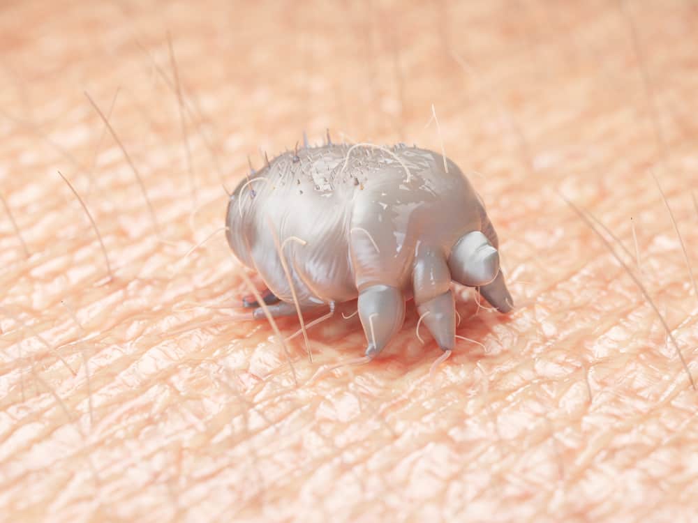 Best Scabies Prevention Tips: Learn What to Do with "Galis"