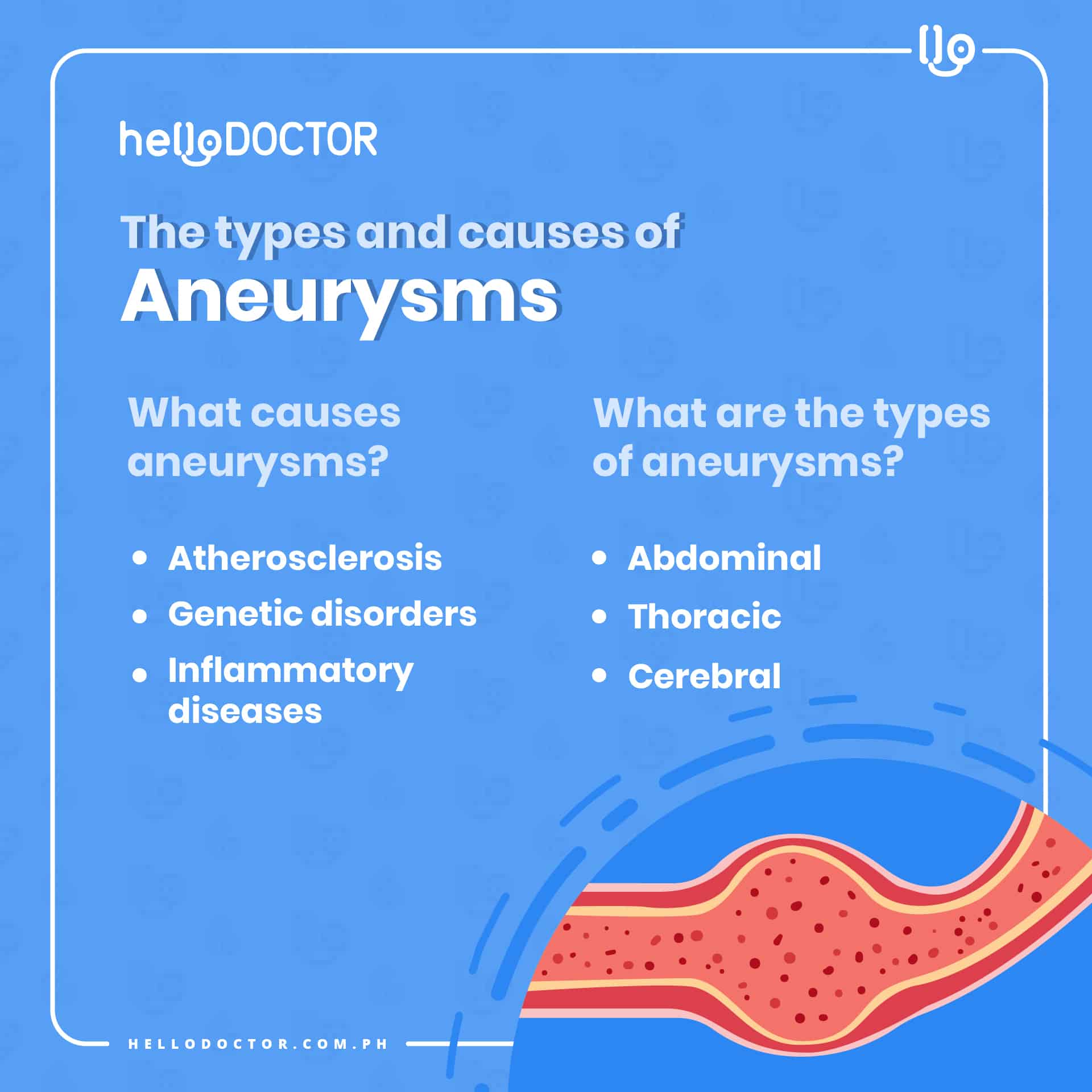 Aneurysm Treatment and Prevention: Everything You Need To Know