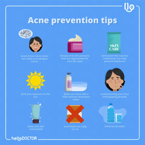The Best Acne Prevention and Treatment Tips - Hello Doctor