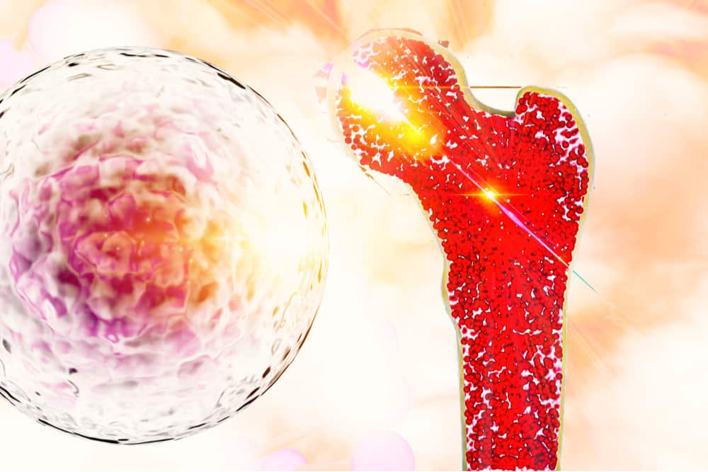 The Early Signs of Bone Cancer: What You Should Know - Hello Doctor