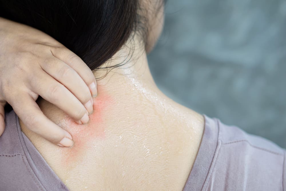 Skin Infection Causes and Treatment - Hello Doctor