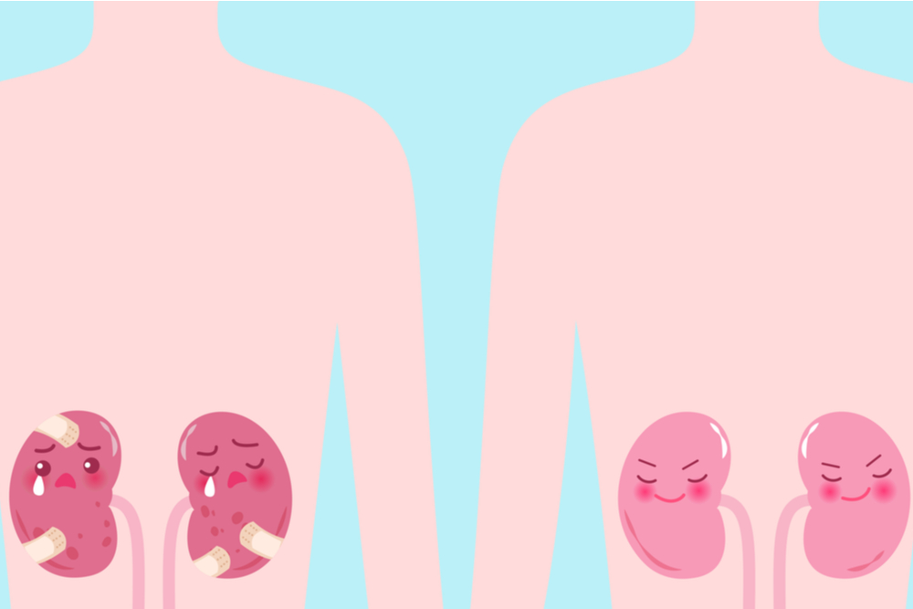 CKD in the Philippines: Important Facts You Need to Know