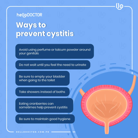 How to Prevent Cystitis Naturally, Best Practices To Consider