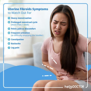 What Is the Main Cause of Myoma? - Important Facts - Hello Doctor