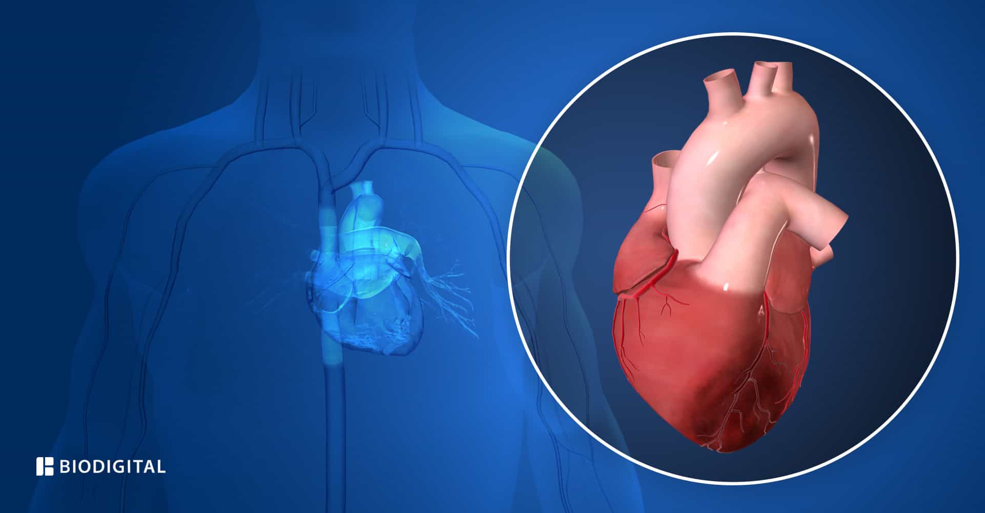 What is a Heart Attack and How Does it Happen? - All You Need to Know
