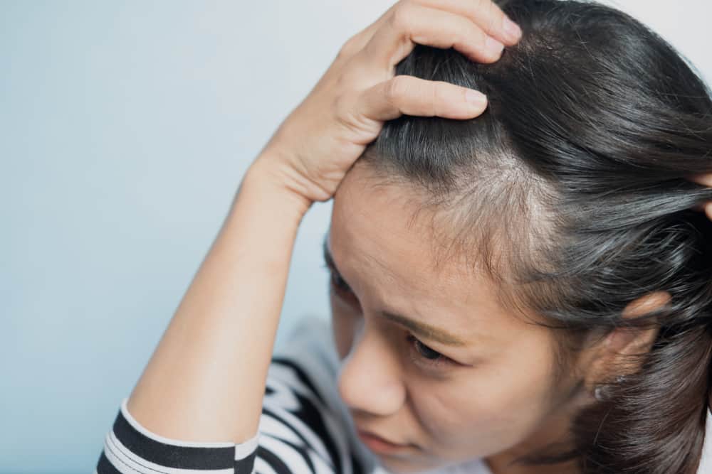 What Causes Seborrheic Dermatitis Flare-Ups? Find Out Here