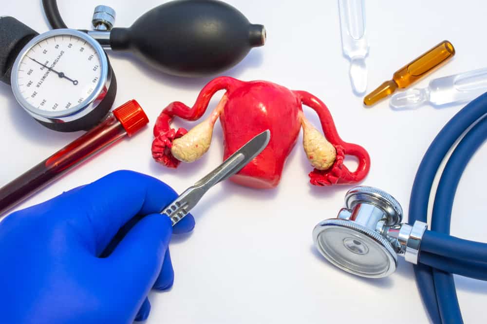 Myoma Treatment Without Surgery - Is It Possible?