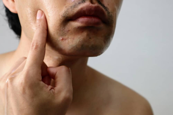 What are the Most Common Skin Problems: Signs and Symptoms