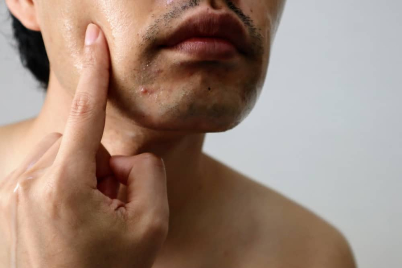 What are the Most Common Skin Problems: Signs and Symptoms
