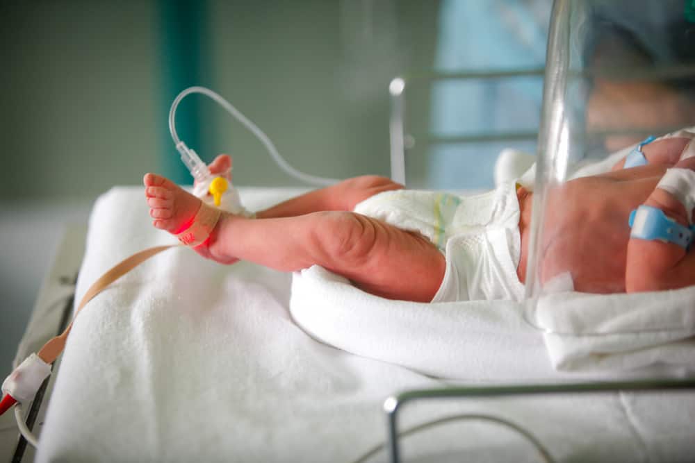 Meconium Aspiration Long-Term Effects and Treatment