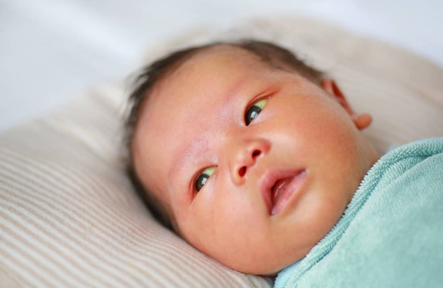 Yellow Baby: What Causes Infant Jaundice and How It's Treated