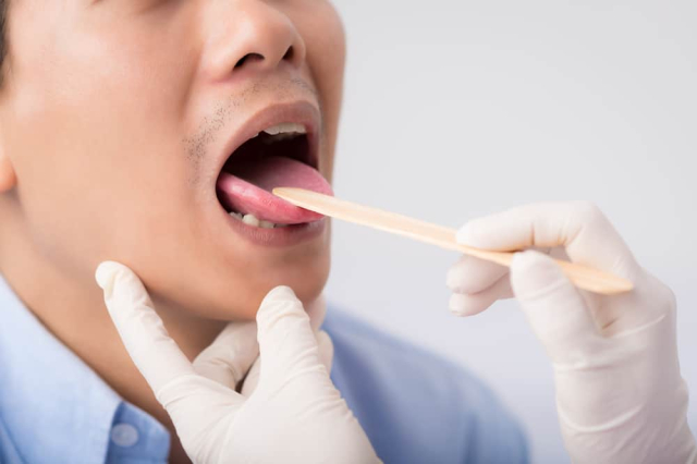 HIV Tongue and Other Telling Signs of HIV/AIDS: The Symptoms to Know