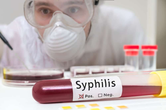 Syphilis Test: When Should You Get One? Find Out Here.