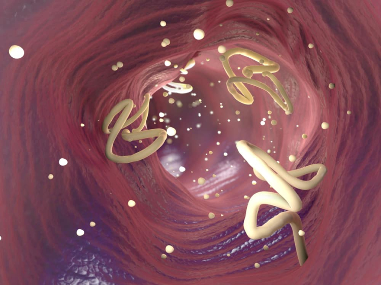 Tapeworm Infection: Will It Be a Cause of Concern?