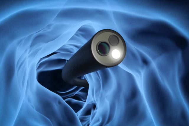 What is a Colonoscopy? Everything You Need to Know