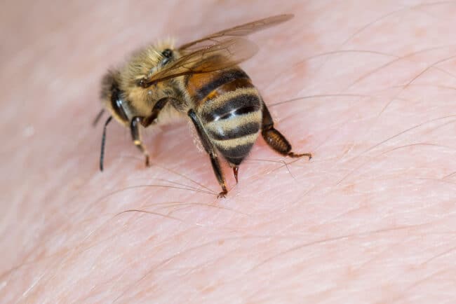 First Aid for Bee Stings: What to Do in Case of Emergency