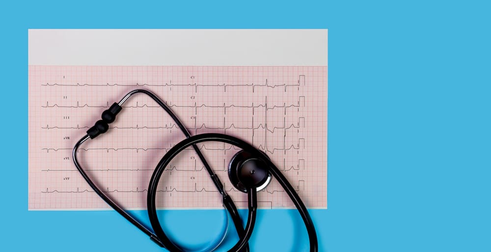 Electrocardiogram (ECG): Why and How Is It Done?