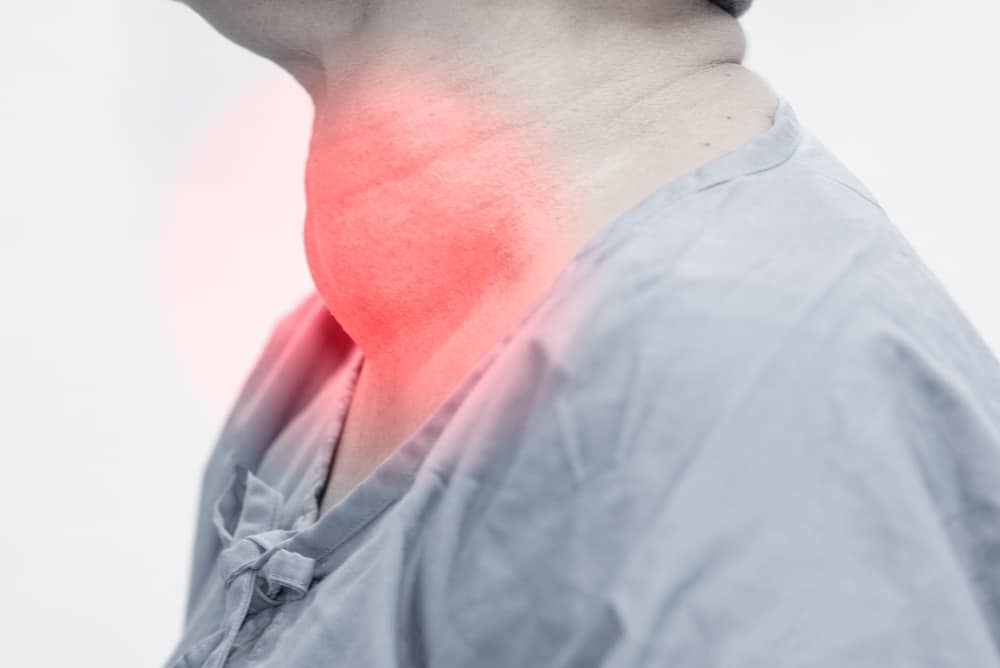 What Is Goiter? And What Are Goiter Symptoms to Watch Out For?