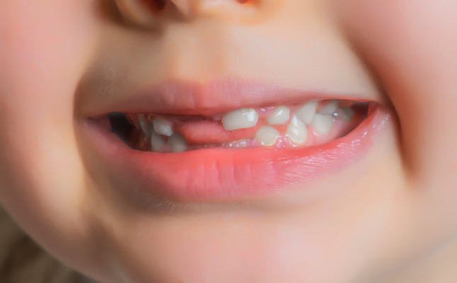When Do Milk Teeth Fall Out in Children? Learn More Here