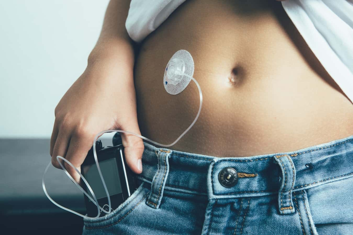 Insulin Pump Pros & Cons: Is It Right For You? What You Need To Know