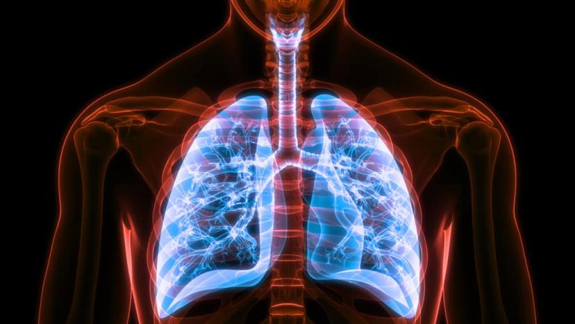Bronchitis vs Bronchiectasis: What's the Difference?