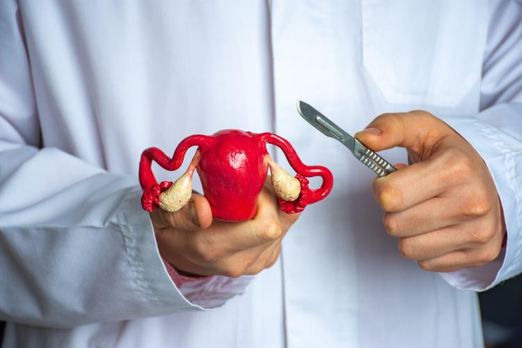 Myomectomy: Surgical Recovery and Further Precautions - Hello Doctor
