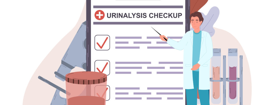 Chyluria Test: Why and How is it Done? How do I Interpret the Results?