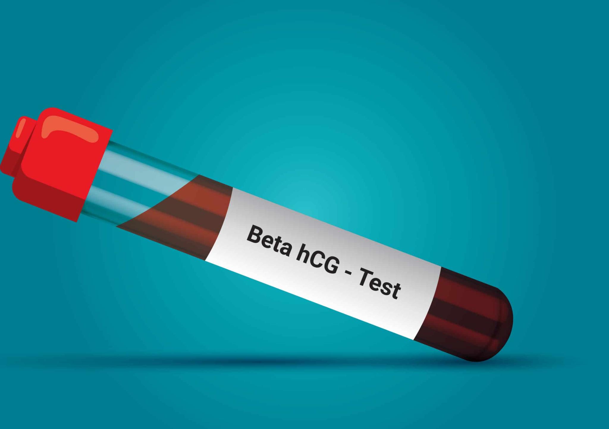 Beta HCG Test: When, Why, and How Is It Done? A Guide for Moms