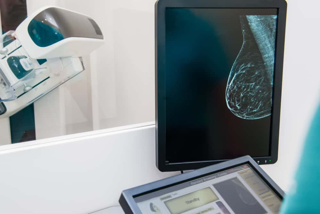 Mammogram Procedure: 7 Frequently Asked Questions, Answered