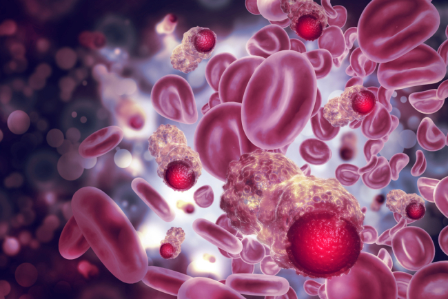 FNAC Test (Fine Needle Aspiration Cytology): Why and How is it Done?