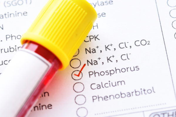 Phosphorus Test: Why and How is it Done? Find Out Here