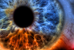 Black Eye: Causes, Treatment, & Complications