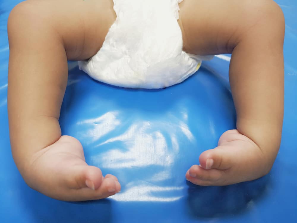 How to Diagnose Birth Defects through Congenital Anomaly Screening