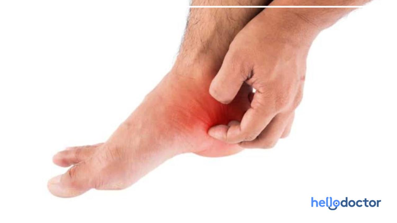 Kulugo: Paano Ito Nagagamot, at Paano Makakaiwas Dito?