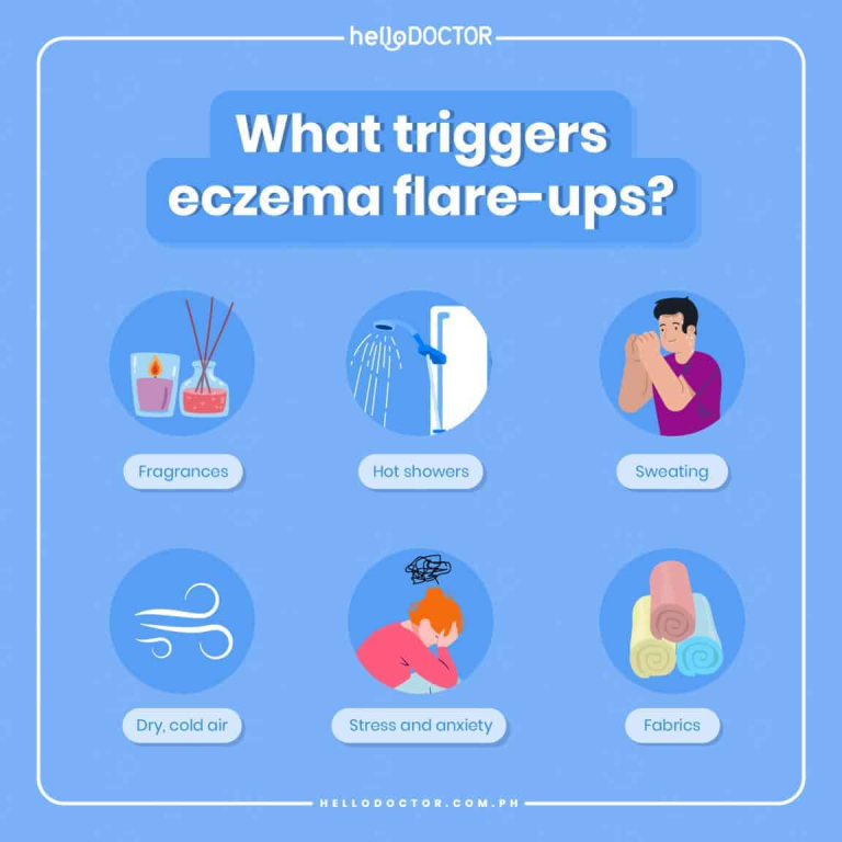 Rashes Sa Bata: Heto Ang Dapat Tandaan Ng Mga Magulang