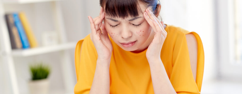 Does Stress Cause Pimples? How Stress Affects Acne
