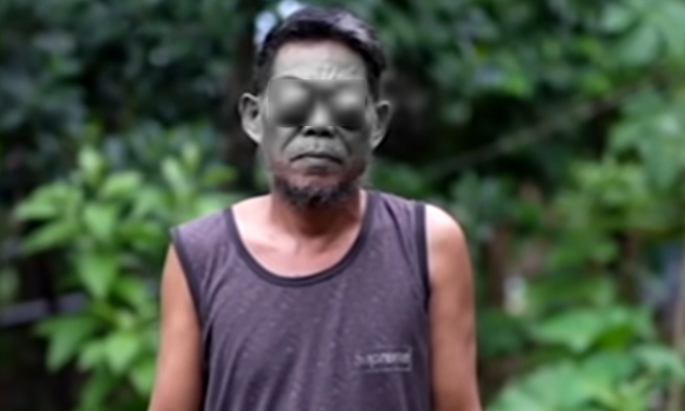 Pamamaga Ng Mata: Ano Ang Sanhi Nito, At Ano Ang Komplikasyon?