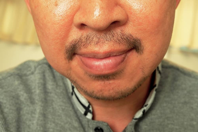 Oil Para Sa Balbas, Nakatutulong Nga Ba Sa Paglago Nito?