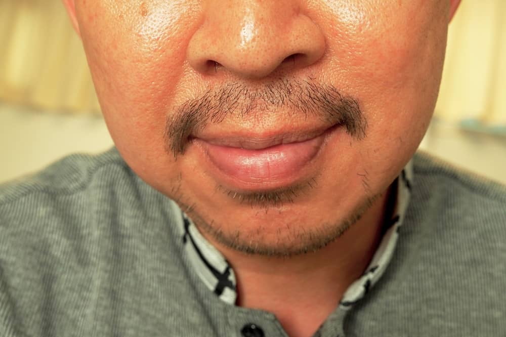 Oil Para Sa Balbas, Nakatutulong Nga Ba Sa Paglago Nito?