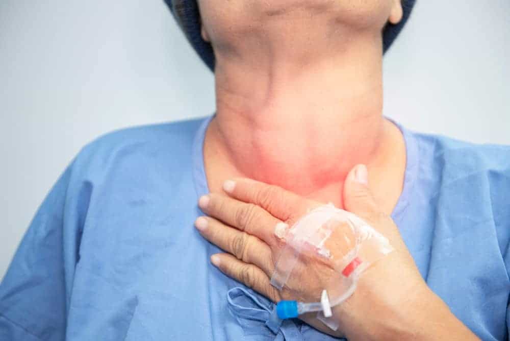 Sanhi Ng Thyroid Cancer, Narito Ang Mga Dapat Mong Malaman!