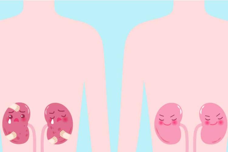 Karaniwang Sakit sa Kidney: Anu-ano ang mga Ito?