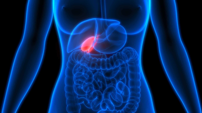 Anu-ano ang Bahagi ng Gallbladder? Narito ang Dapat Niyong Malaman