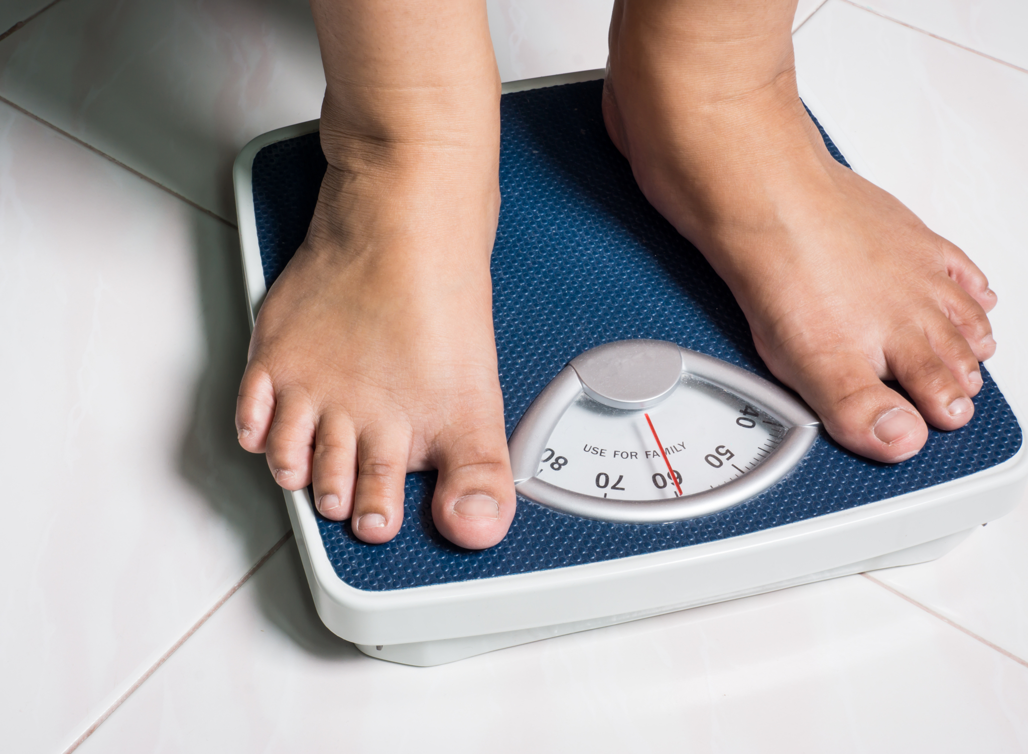 Treating Obesity in the Philippines: What Options are Available?